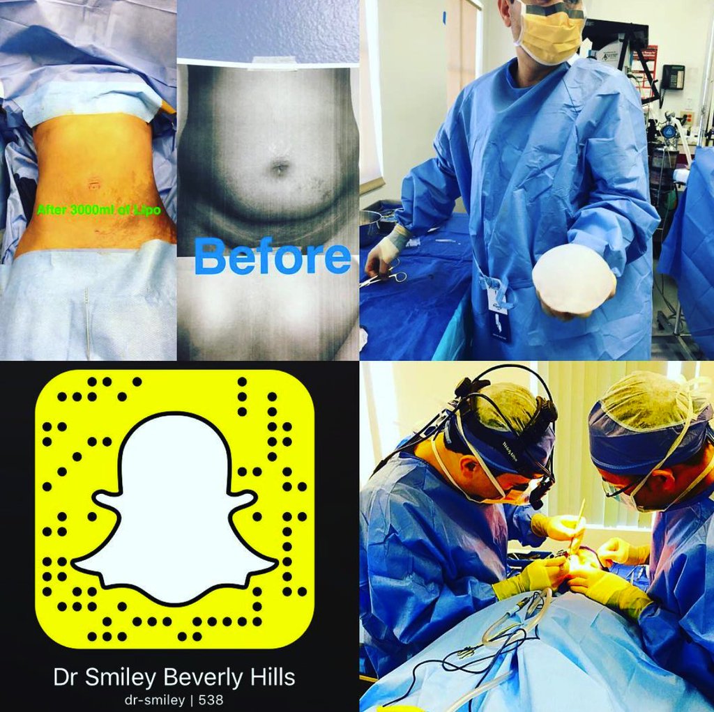 Renowned Beverly Hills Plastic Surgeon Uses Snapchat To Educate